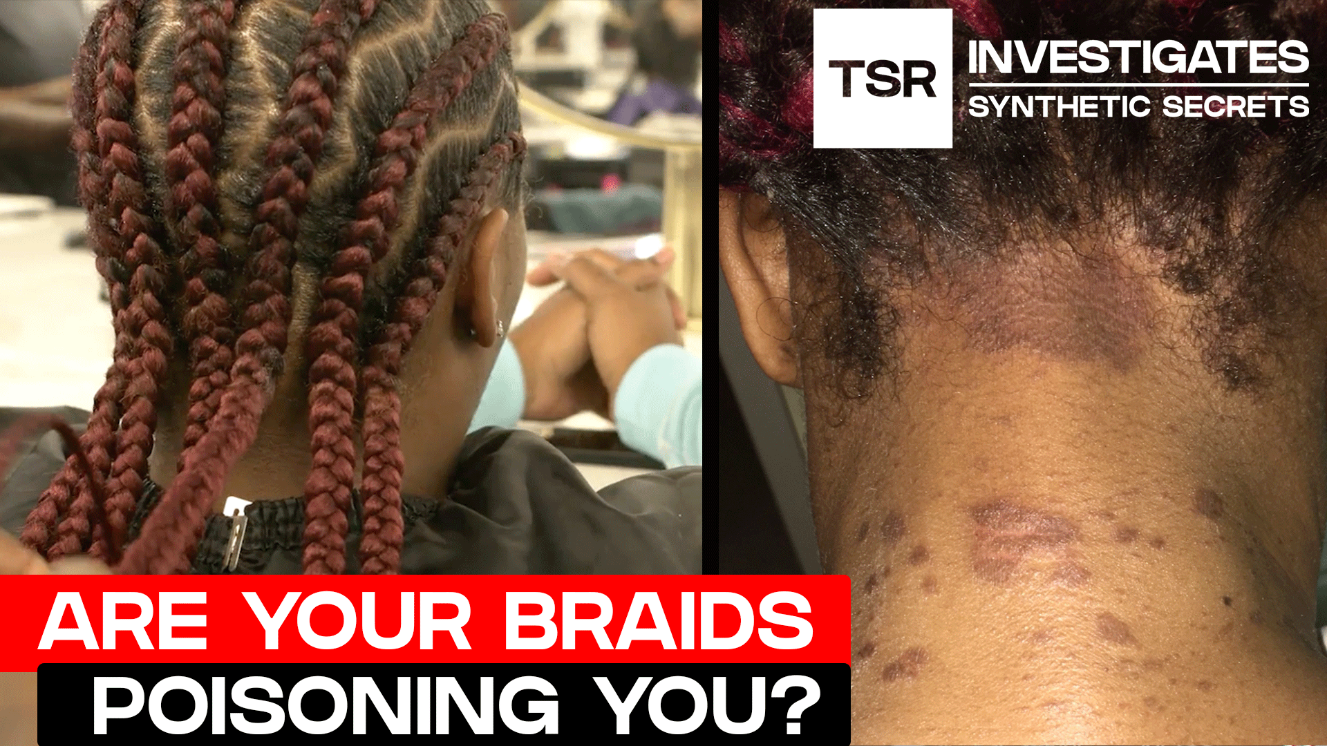 Synthetic Hair Investigation: Are Your Braids Toxic? Poisoning You?